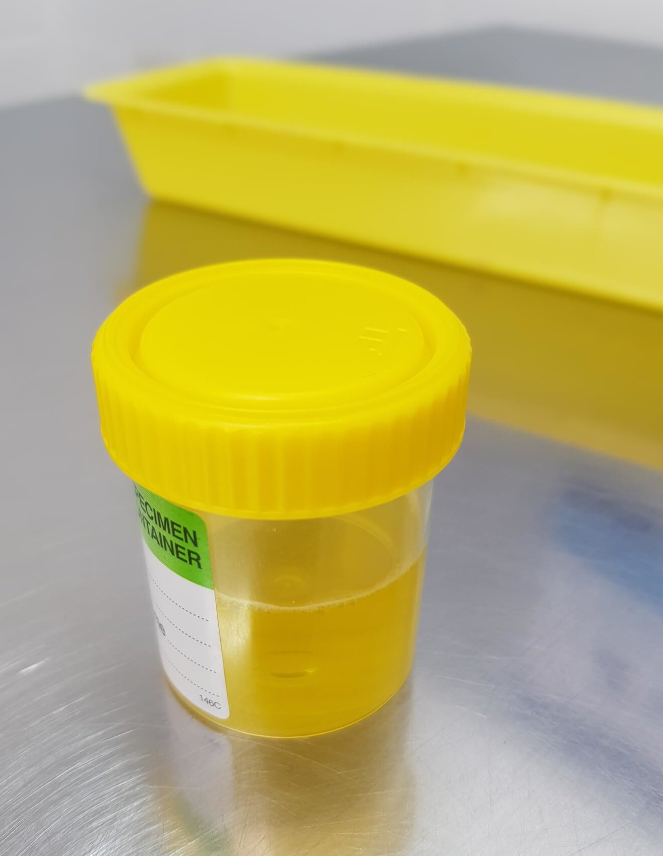 Wee testing is also important. - Brandon Park Veterinary Hospital